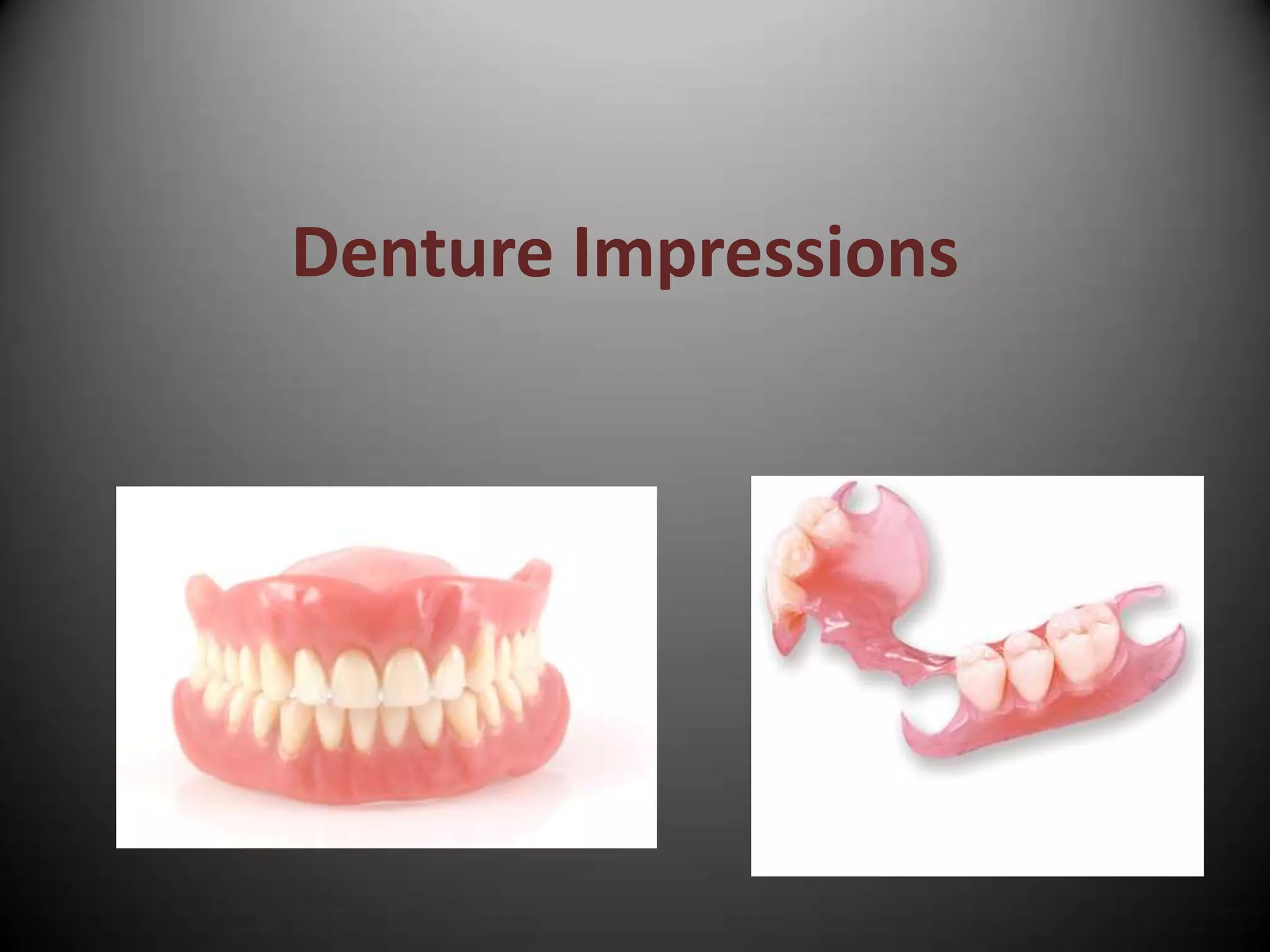 Denture impressions slides | PPTX