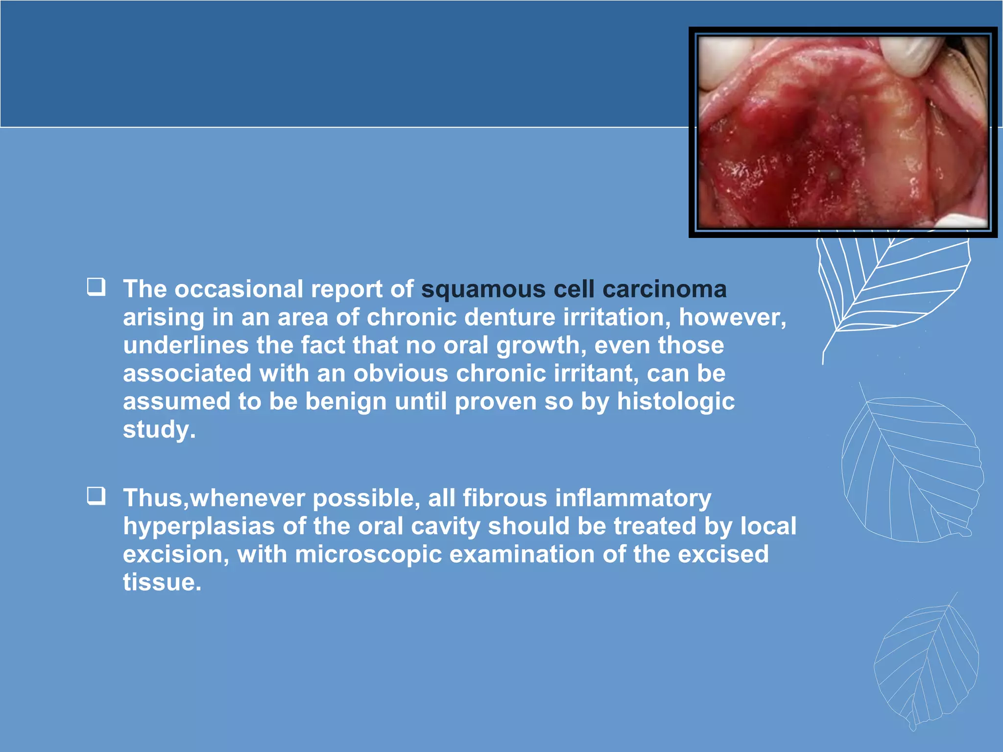 Denture induced lesions- Aarti Dubey | PPT