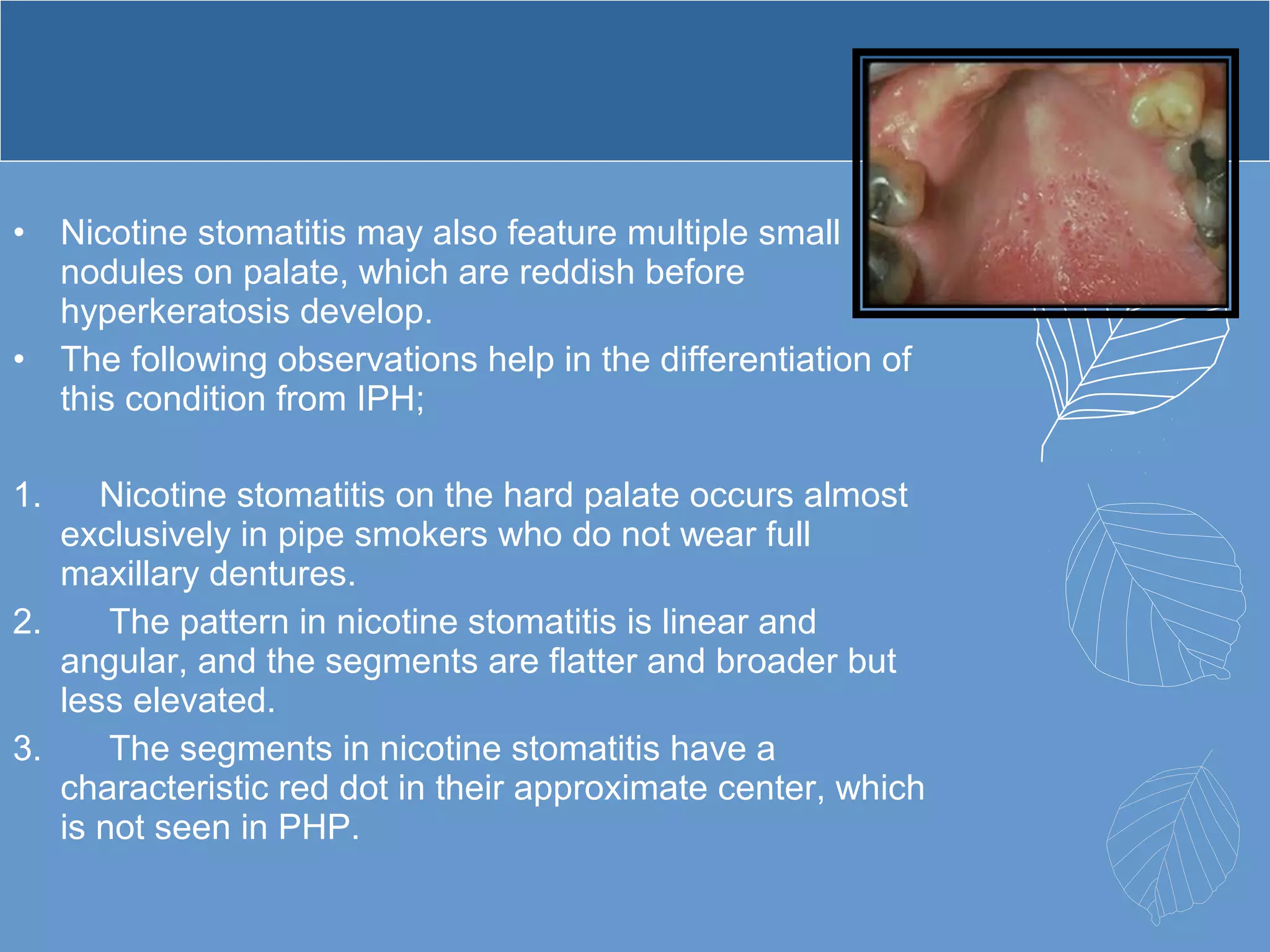 Denture induced lesions- Aarti Dubey | PPT