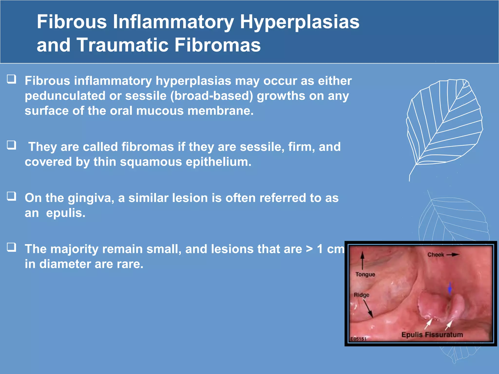 Denture induced lesions- Aarti Dubey | PPT