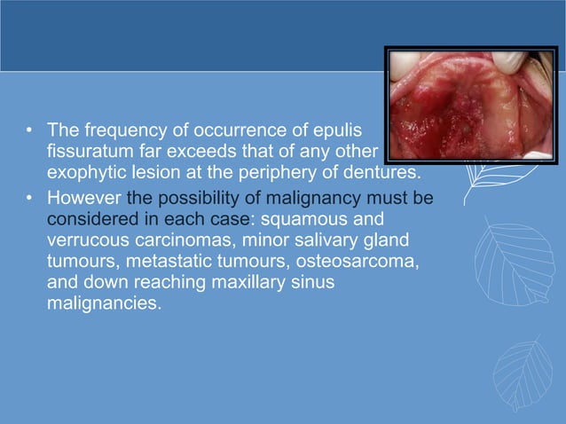 Denture induced lesions- Aarti Dubey | PPT