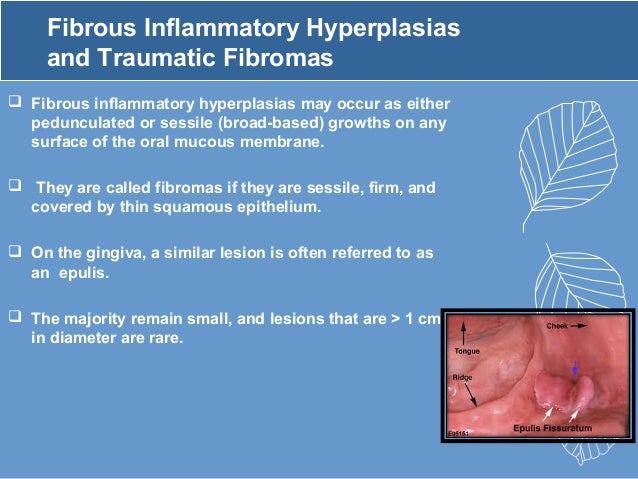 Denture induced lesions- Aarti Dubey