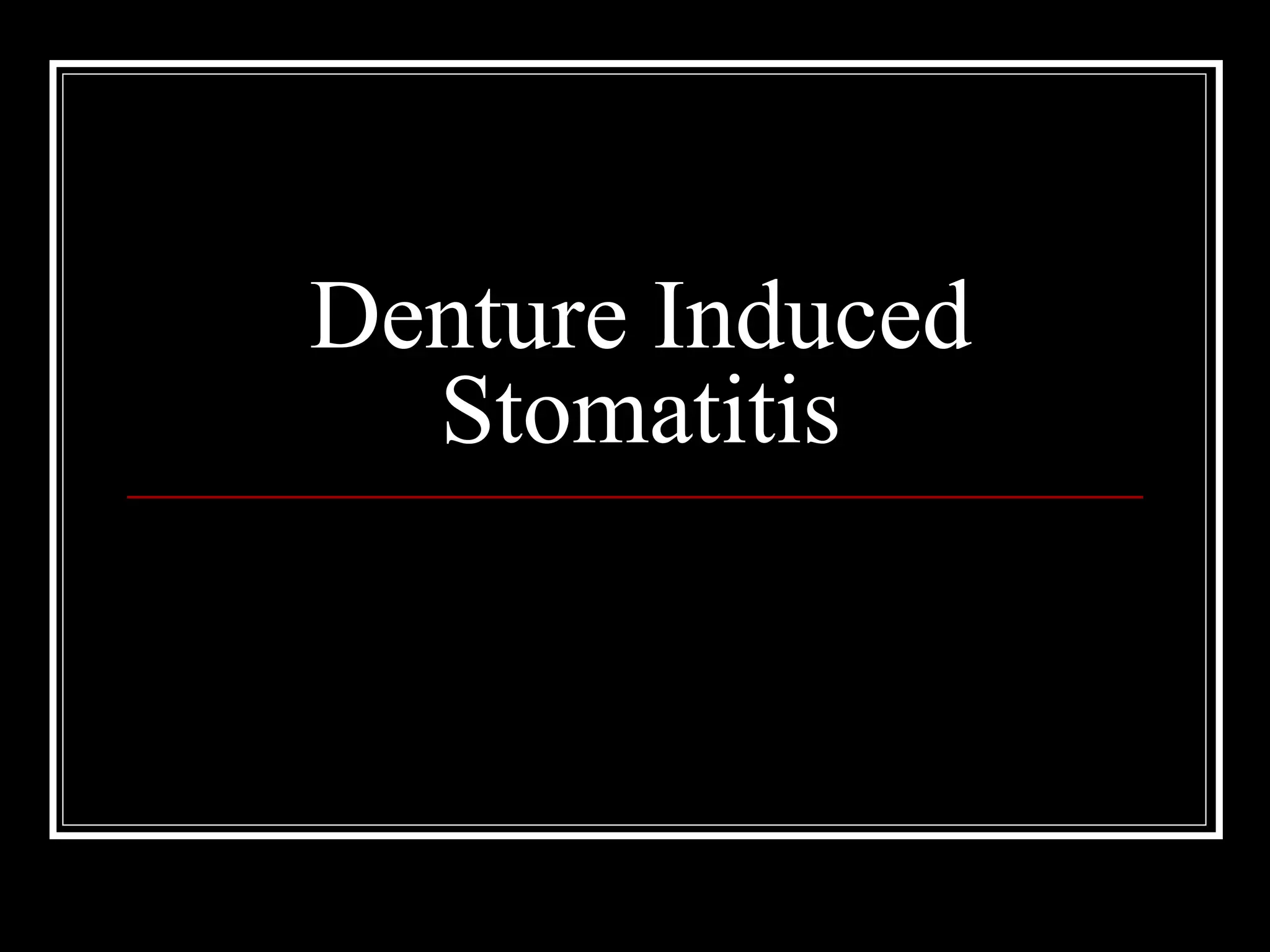 Denture Stomatitis | PPTX
