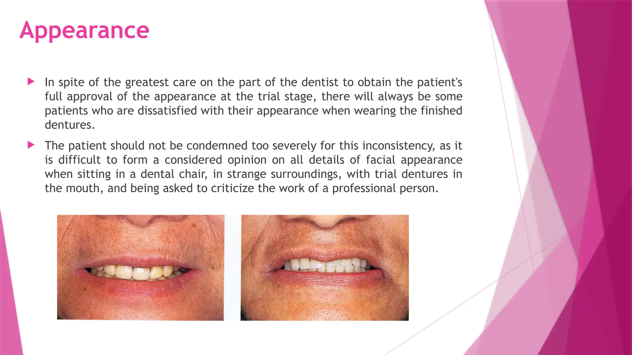 Denture Insertion, Post insertion Instructions, Problem.pptx