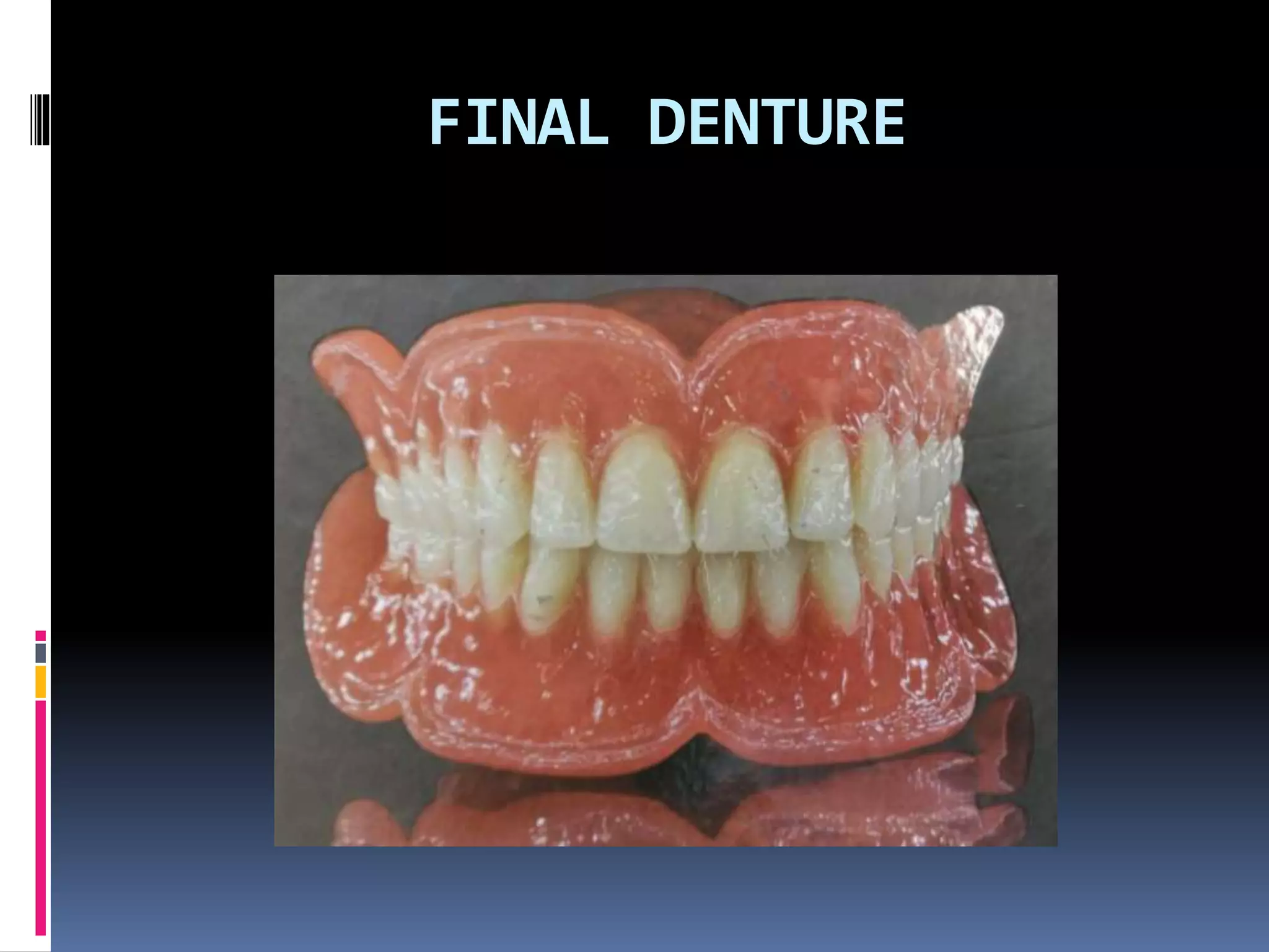 Denture processing | PPTX | Oral care | Personal Care