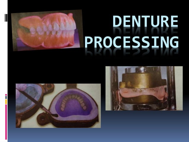Denture processing | PPTX | Oral care | Personal Care