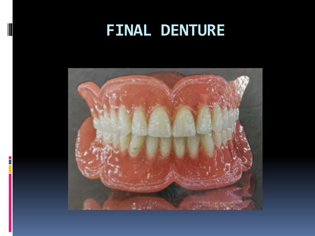 Denture processing | PPTX | Oral care | Personal Care