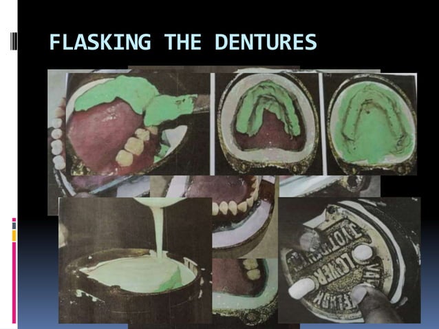 Denture processing | PPTX | Oral care | Personal Care