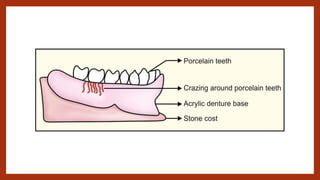 Denture processing.pptx