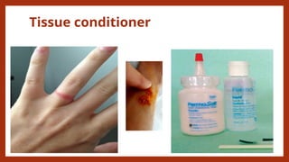 Denture Relining & Rebasing - Dental Materials | PPTX