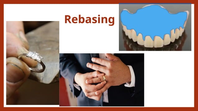Denture Relining & Rebasing - Dental Materials | PPTX