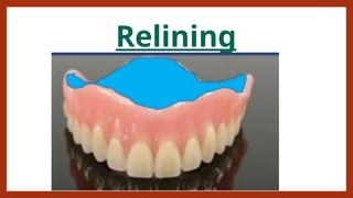 Denture Relining & Rebasing - Dental Materials | PPTX
