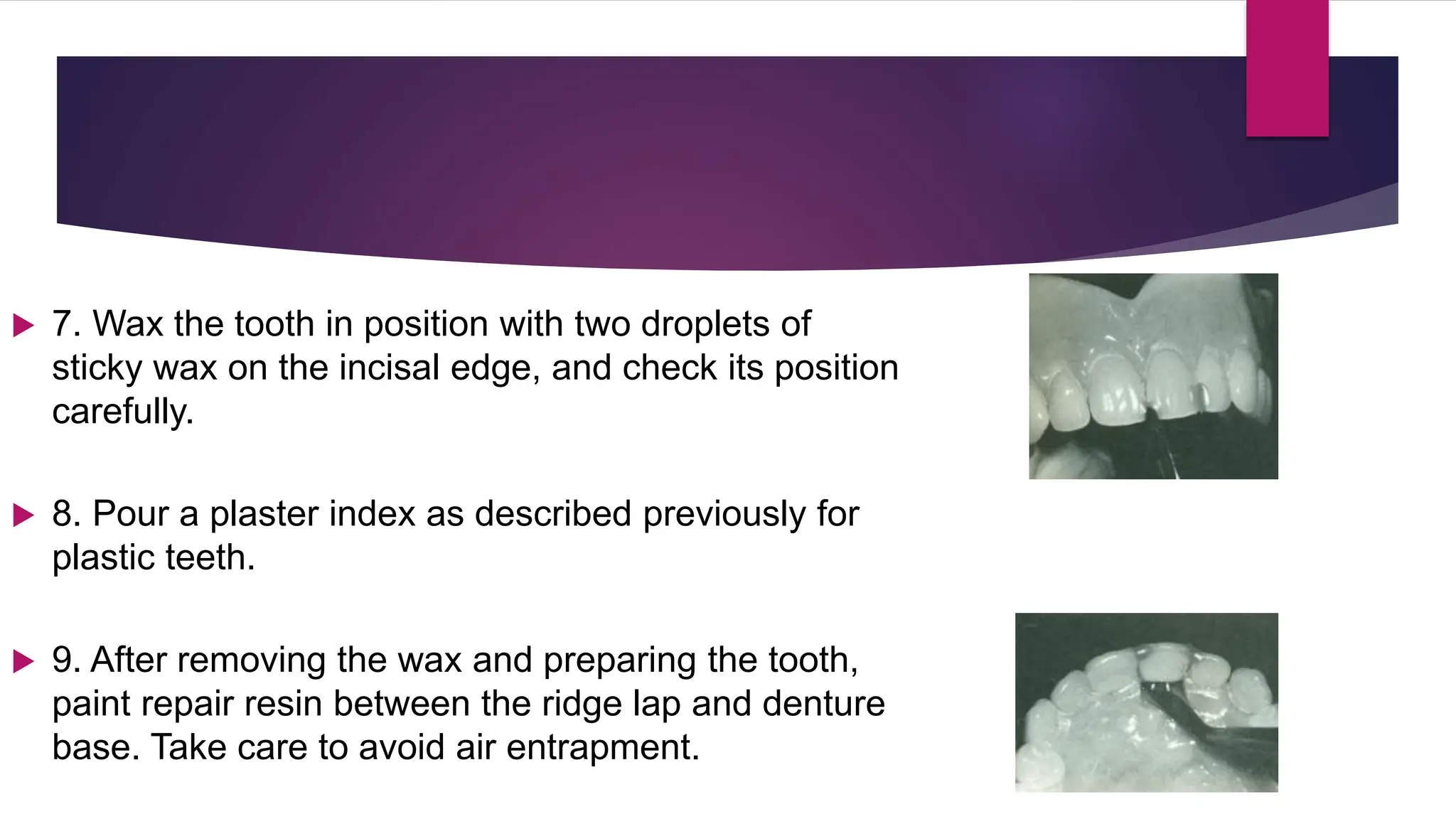 Denture repair in complete dentures .pptx