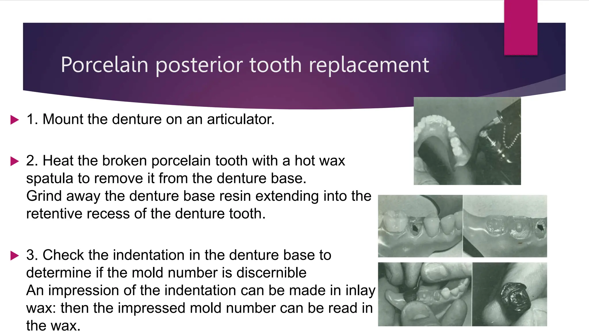 Denture repair in complete dentures .pptx