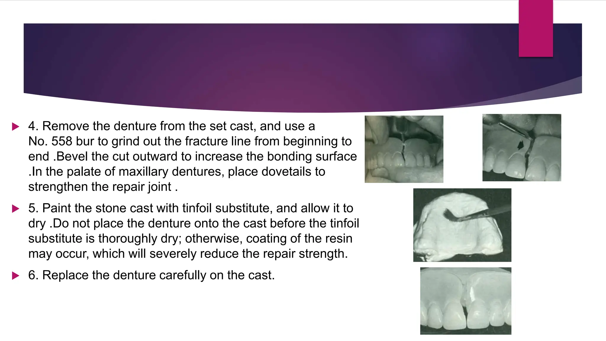 Denture repair in complete dentures .pptx