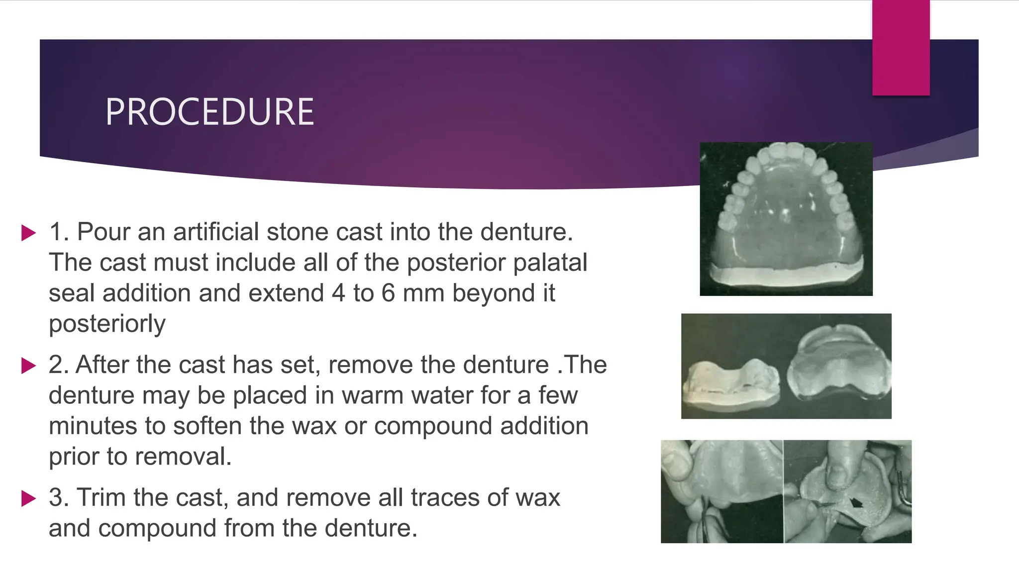 Denture repair in complete dentures .pptx