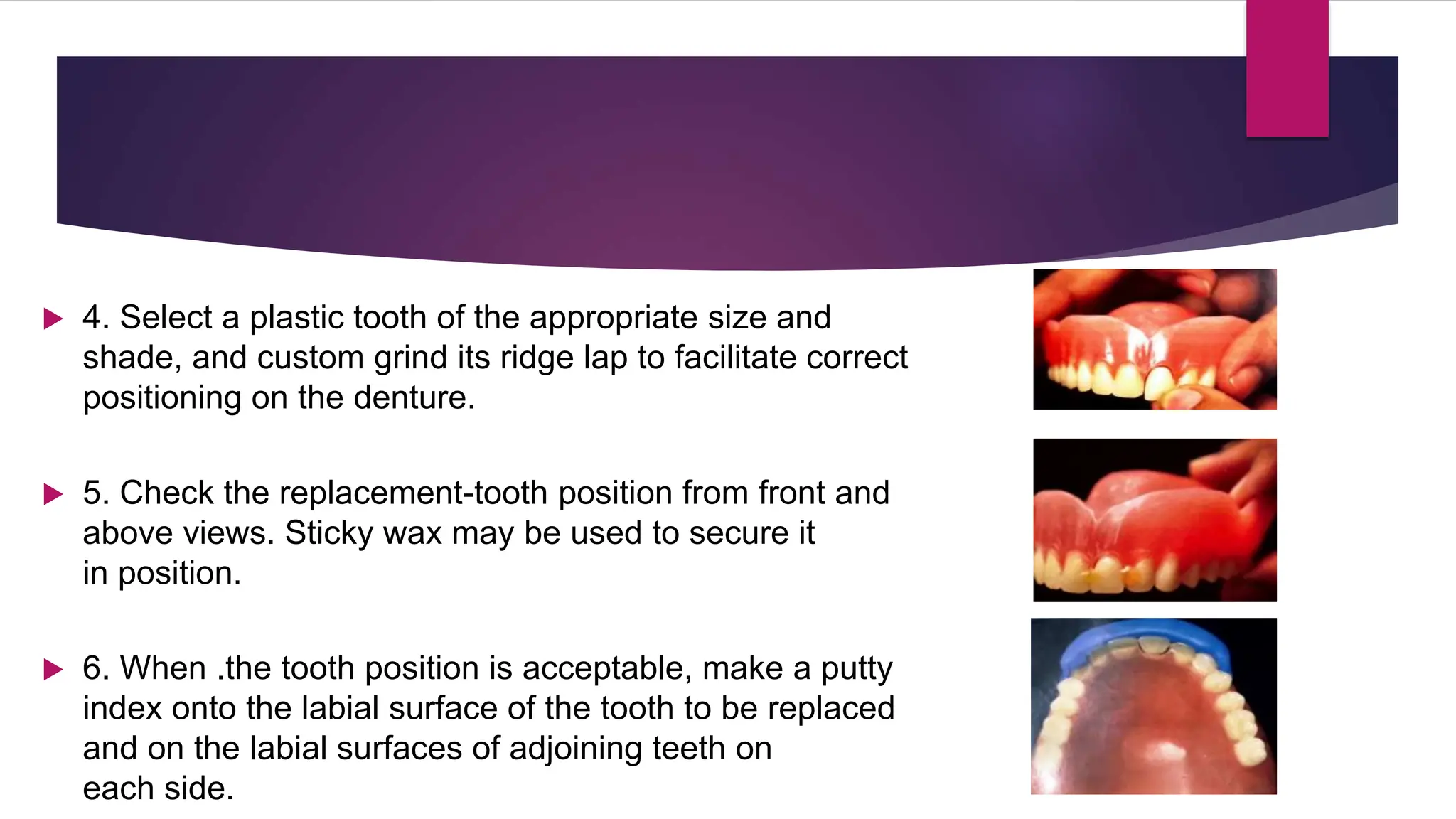 Denture repair in complete dentures .pptx