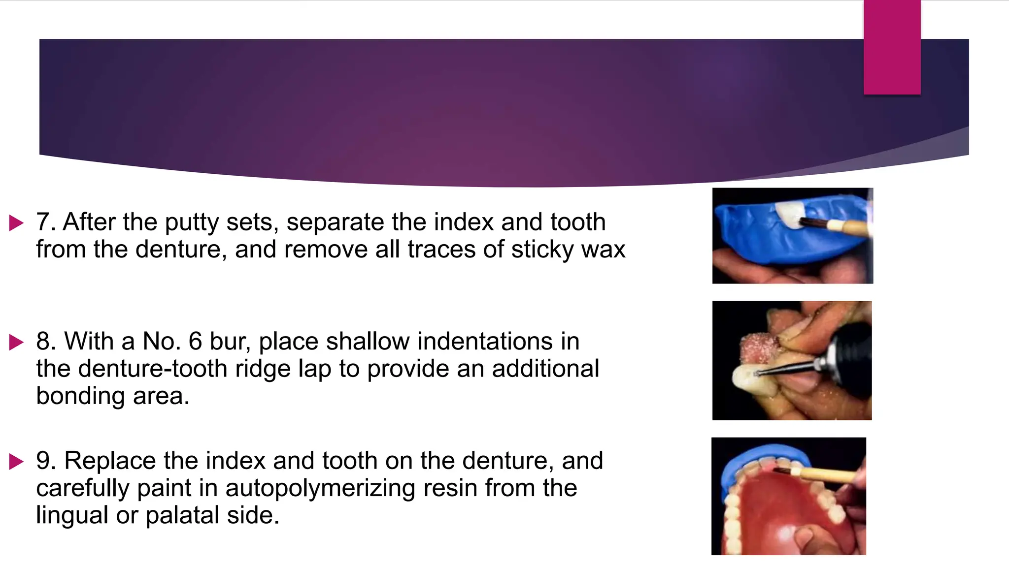 Denture repair in complete dentures .pptx