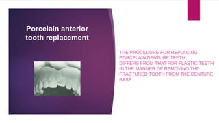 Denture repair in complete dentures .pptx