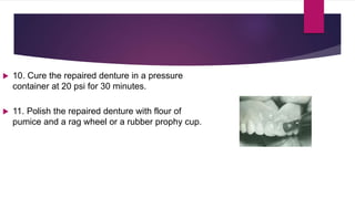 Denture repair in complete dentures .pptx