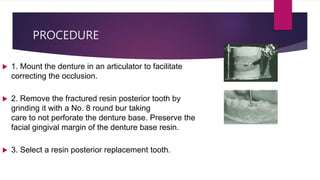 Denture repair in complete dentures .pptx