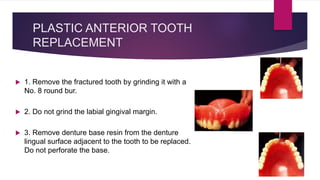 Denture repair in complete dentures .pptx