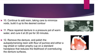 Denture repair in complete dentures .pptx