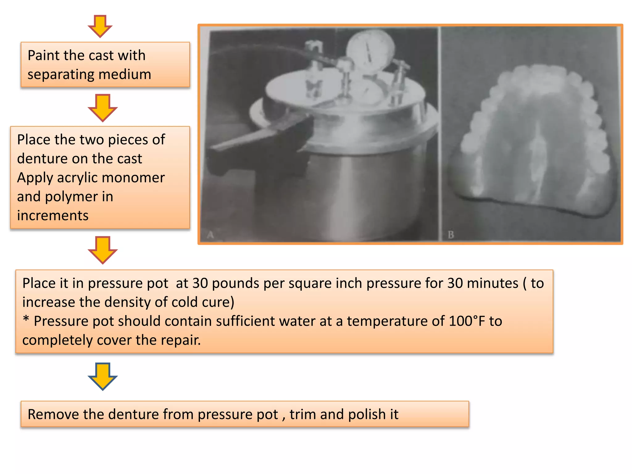 DENTURE REPAIR_112600.pptx