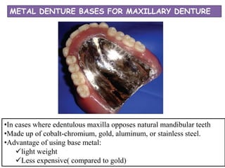 DENTURE REPAIR_112600.pptx