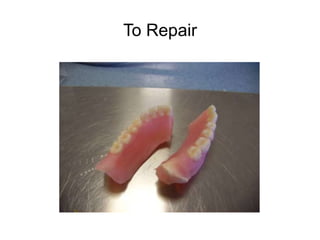 Denture repairs | PPTX