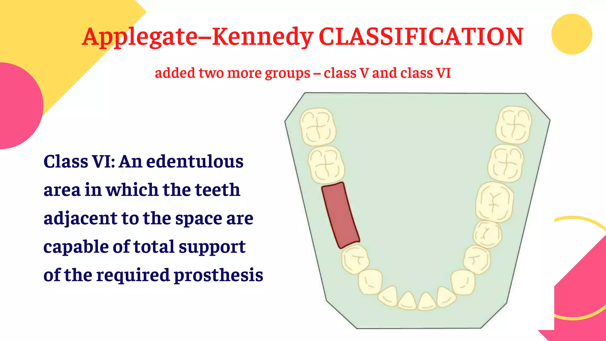DENTURES - CLASSIFICATION OF PARTIALLY EDENTULOUS ARCHES - CLASPS.pdf ...