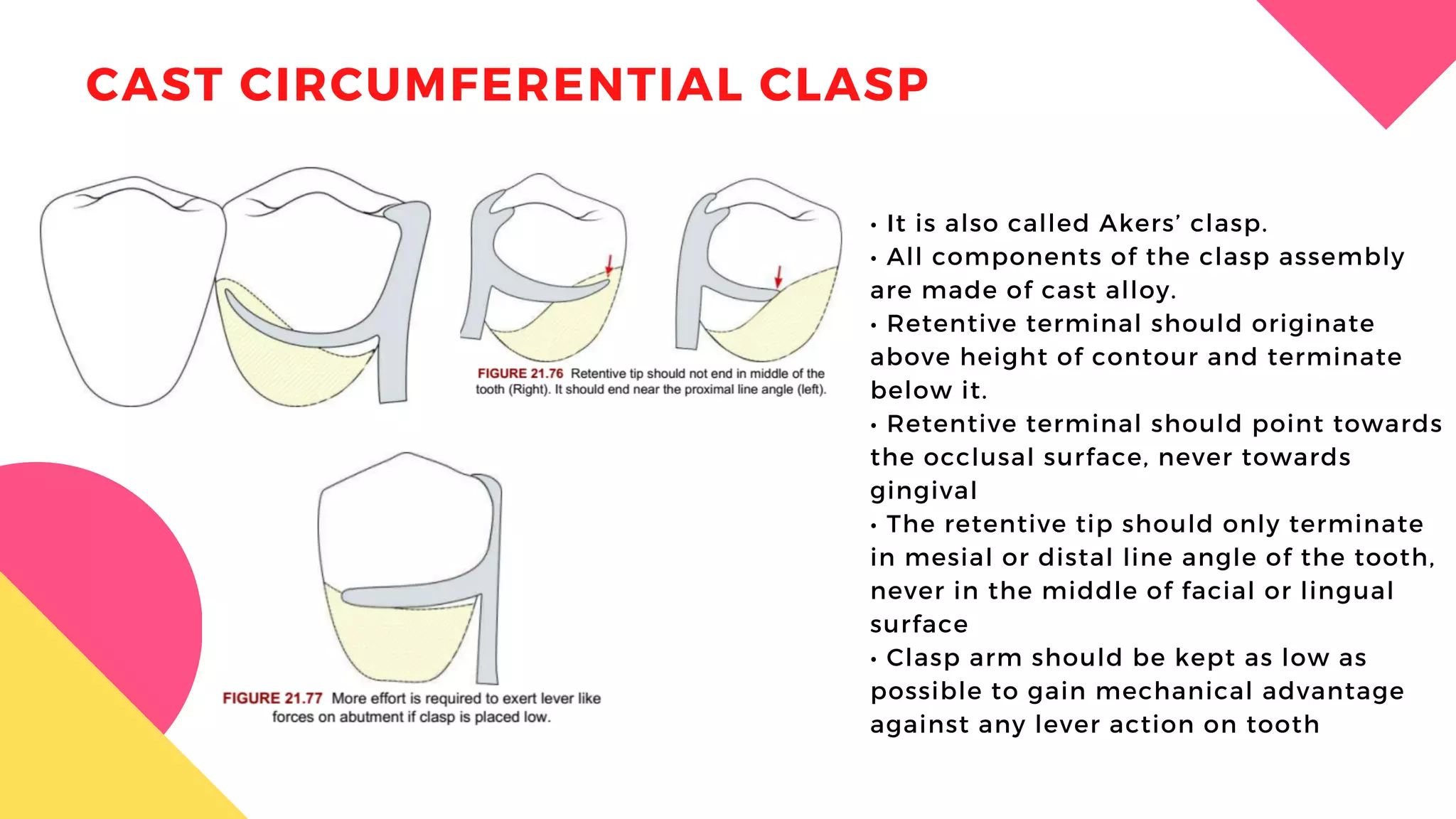 DENTURES - CLASSIFICATION OF PARTIALLY EDENTULOUS ARCHES - CLASPS.pdf ...