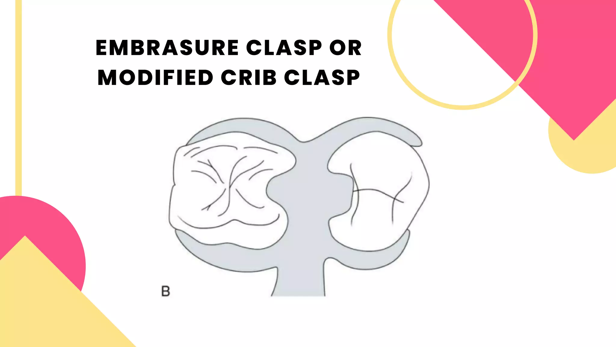 DENTURES - CLASSIFICATION OF PARTIALLY EDENTULOUS ARCHES - CLASPS.pdf ...