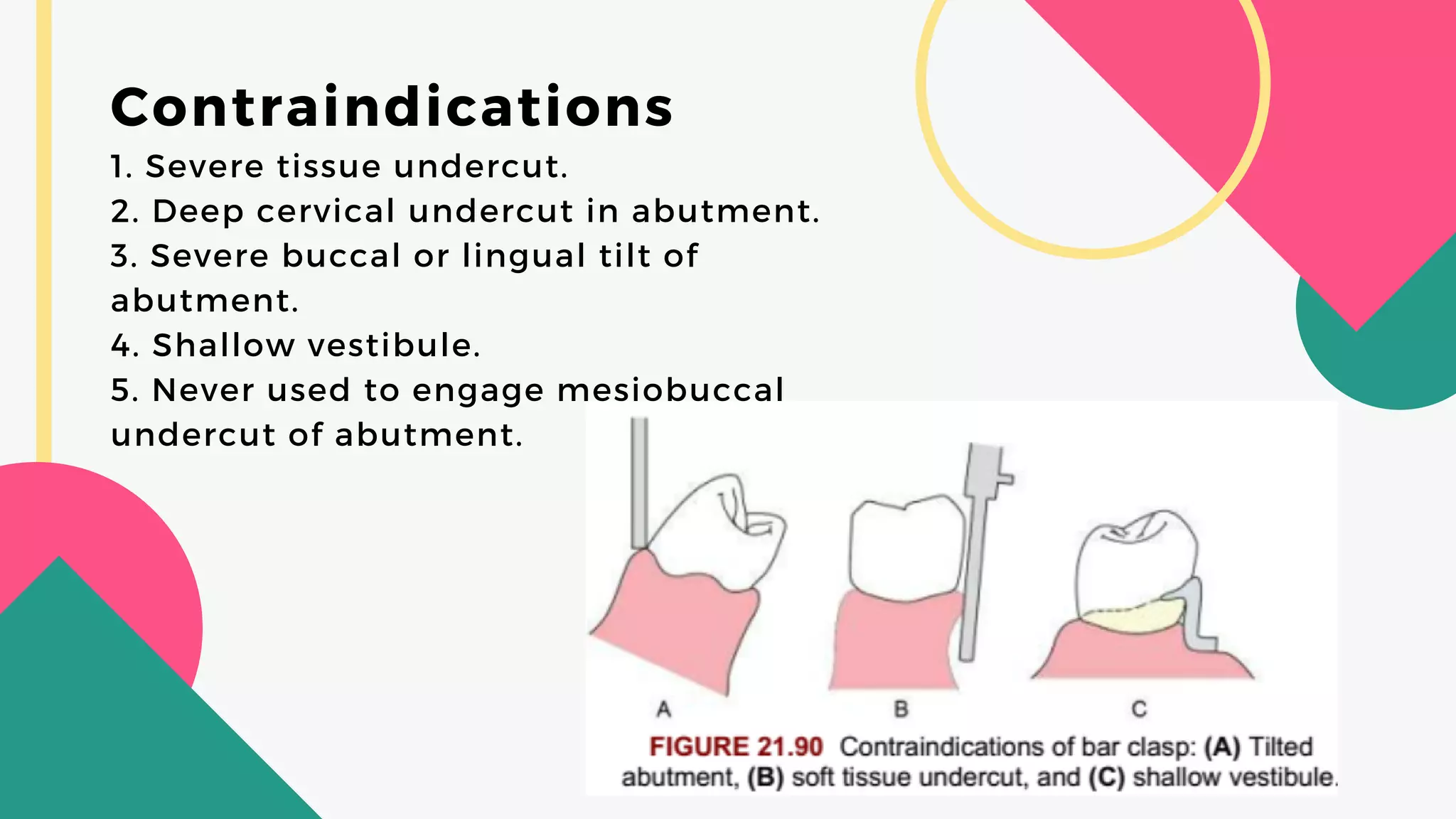 DENTURES - CLASSIFICATION OF PARTIALLY EDENTULOUS ARCHES - CLASPS.pdf ...