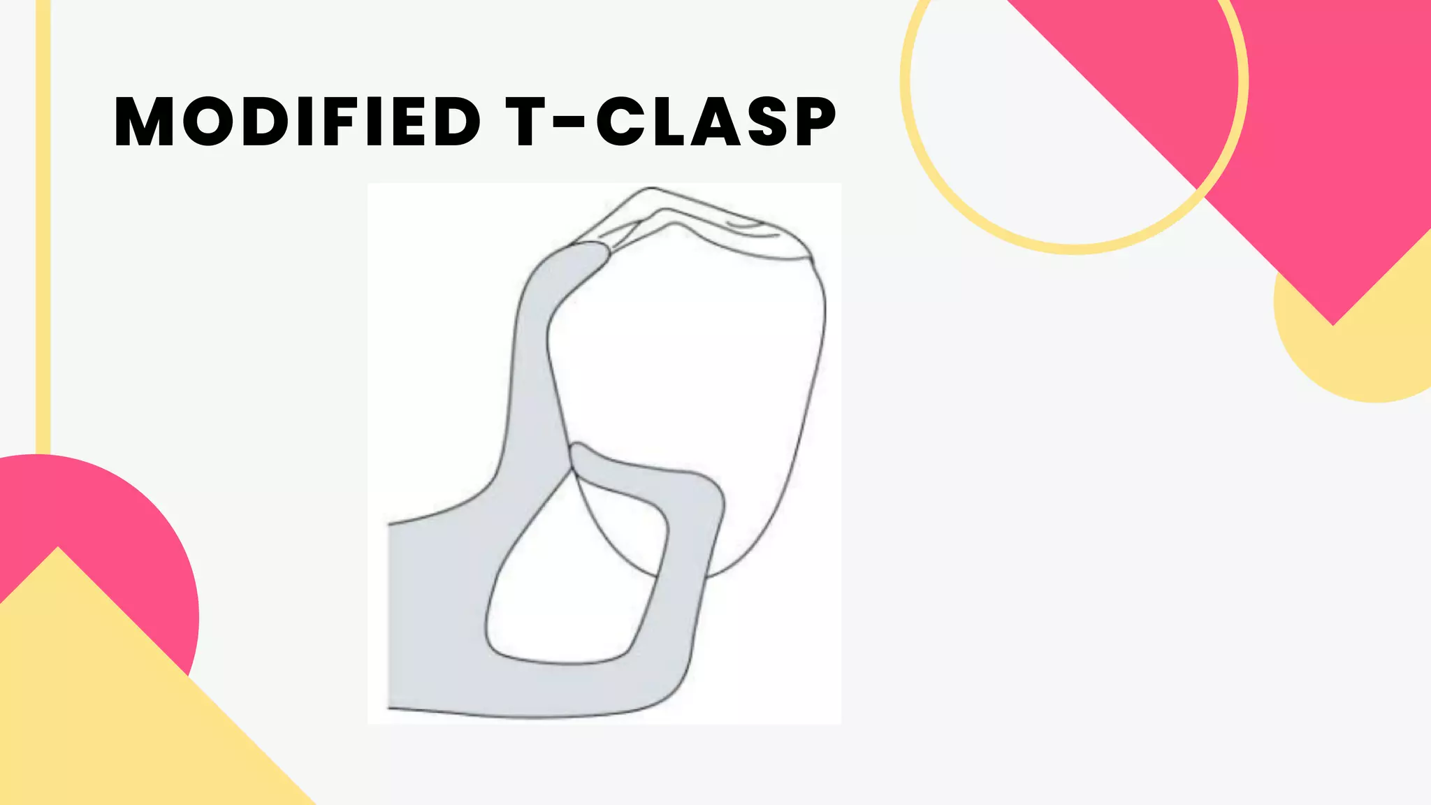 DENTURES - CLASSIFICATION OF PARTIALLY EDENTULOUS ARCHES - CLASPS.pdf ...