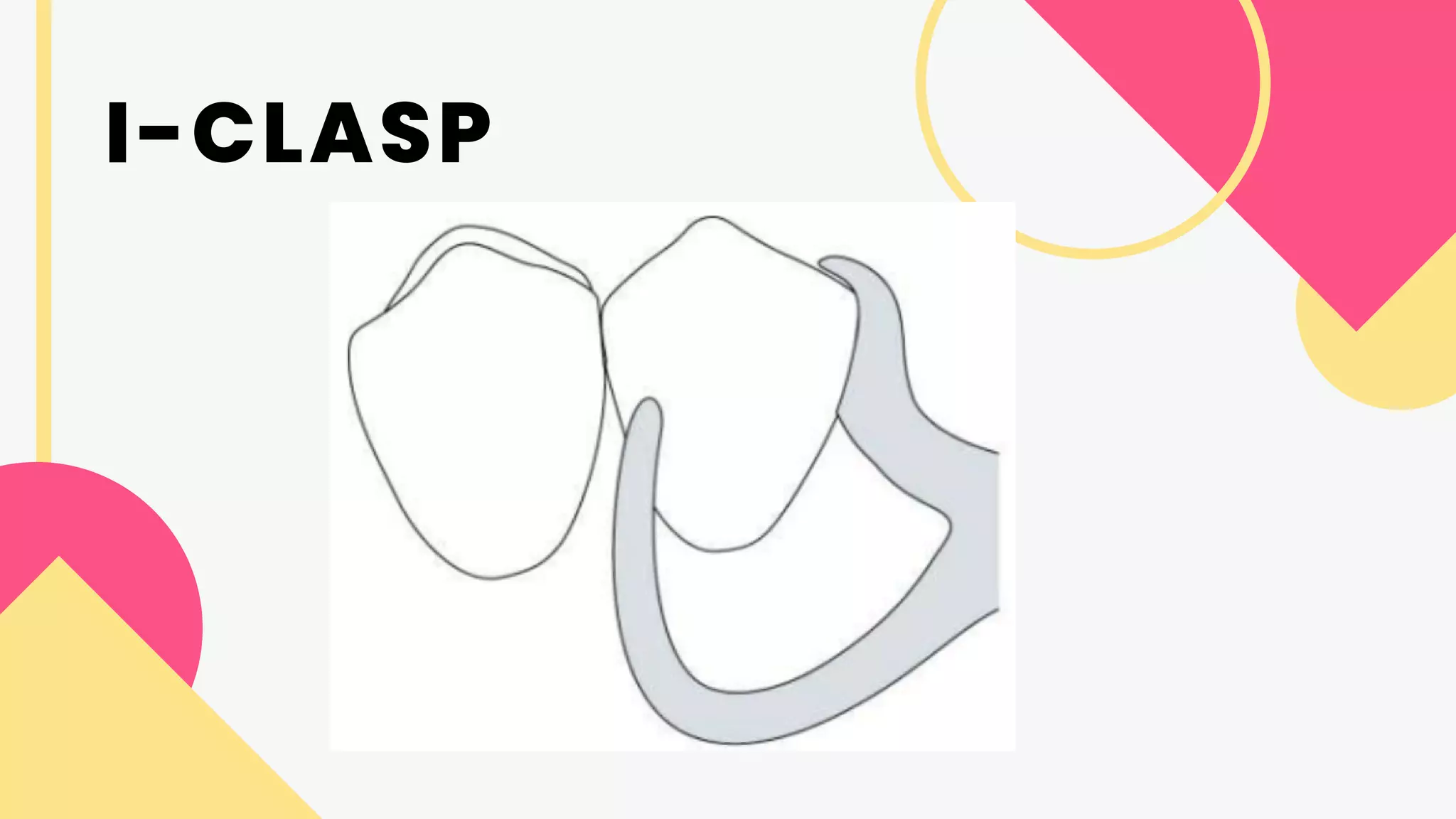DENTURES - CLASSIFICATION OF PARTIALLY EDENTULOUS ARCHES - CLASPS.pdf ...