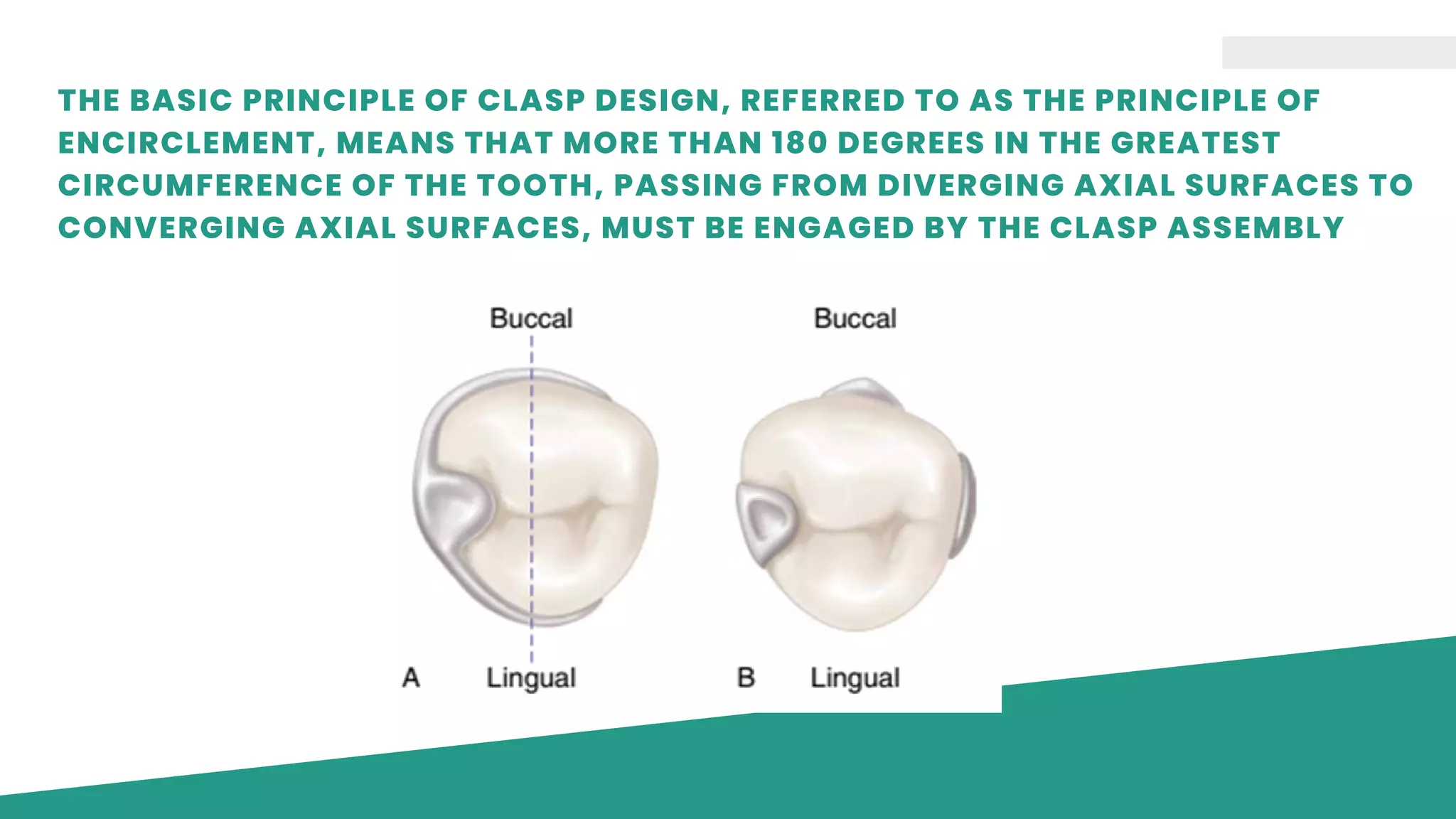 DENTURES - CLASSIFICATION OF PARTIALLY EDENTULOUS ARCHES - CLASPS.pdf ...