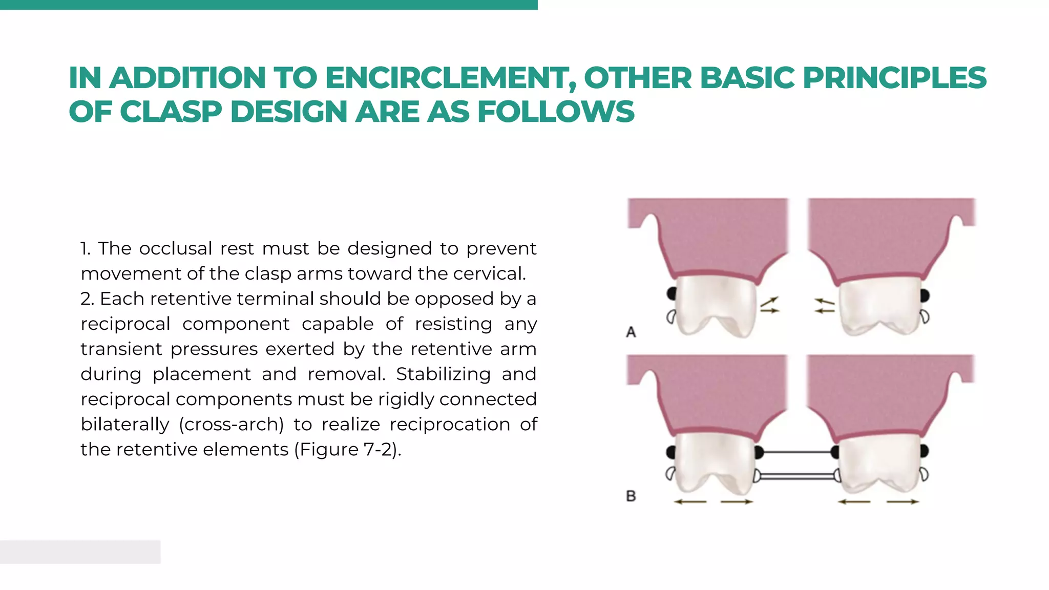 DENTURES - CLASSIFICATION OF PARTIALLY EDENTULOUS ARCHES - CLASPS.pdf ...