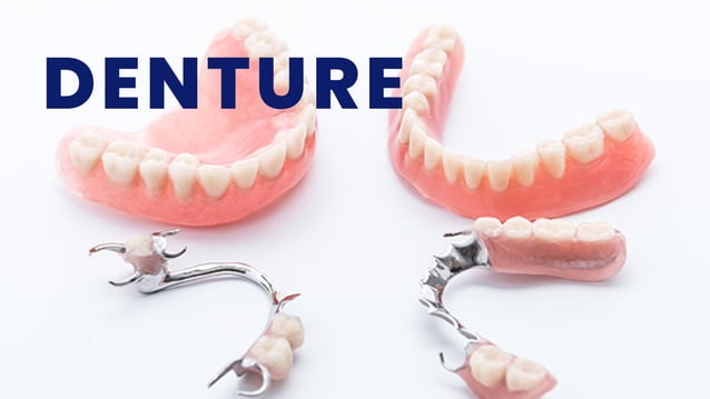 DENTURES - CLASSIFICATION OF PARTIALLY EDENTULOUS ARCHES - CLASPS.pdf ...