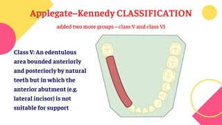 DENTURES - CLASSIFICATION OF PARTIALLY EDENTULOUS ARCHES - CLASPS.pdf