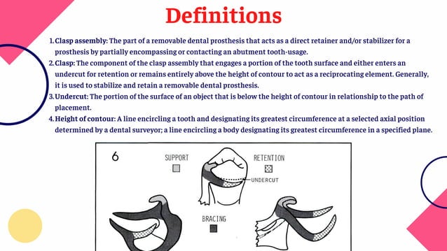 DENTURES - CLASSIFICATION OF PARTIALLY EDENTULOUS ARCHES - CLASPS.pdf ...