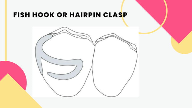 DENTURES - CLASSIFICATION OF PARTIALLY EDENTULOUS ARCHES - CLASPS.pdf ...