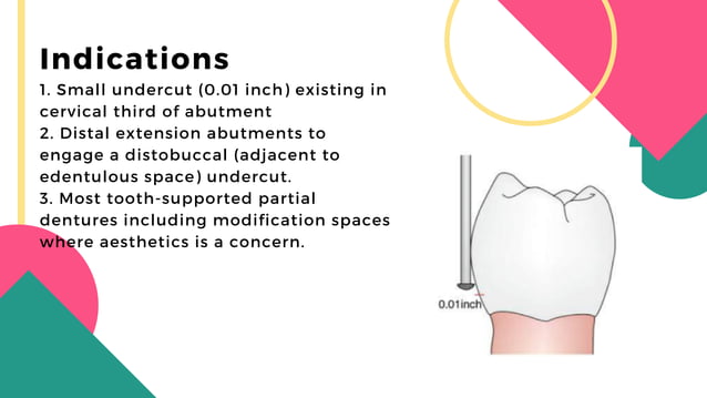 DENTURES - CLASSIFICATION OF PARTIALLY EDENTULOUS ARCHES - CLASPS.pdf ...
