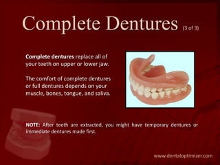 The Facts About Dentures | PPTX