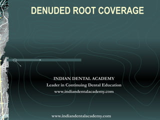 Denuded root coverage /certified fixed orthodontic courses by Indian ...