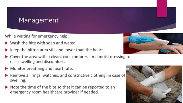Types of Snakes bite and their management | PPT
