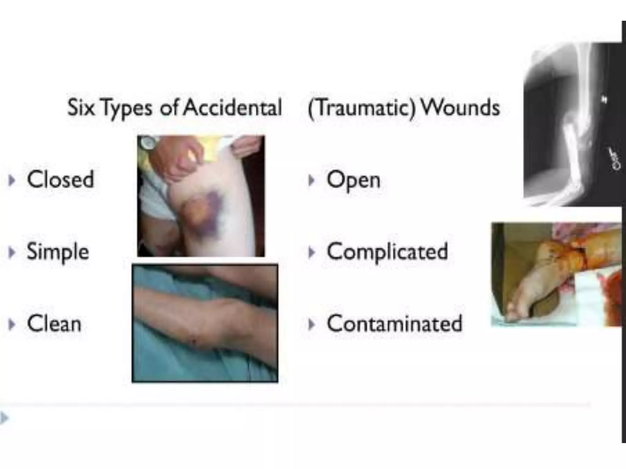 Department of oral & maxillofacial surgery (Wound healing ) | PPTX