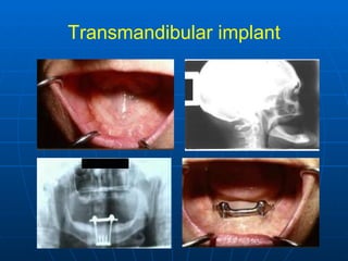 Approach to Dentistry - Oral and Maxillofacial Surgery