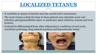 Actinomycosis, Tetanus, Syphilis.pptx