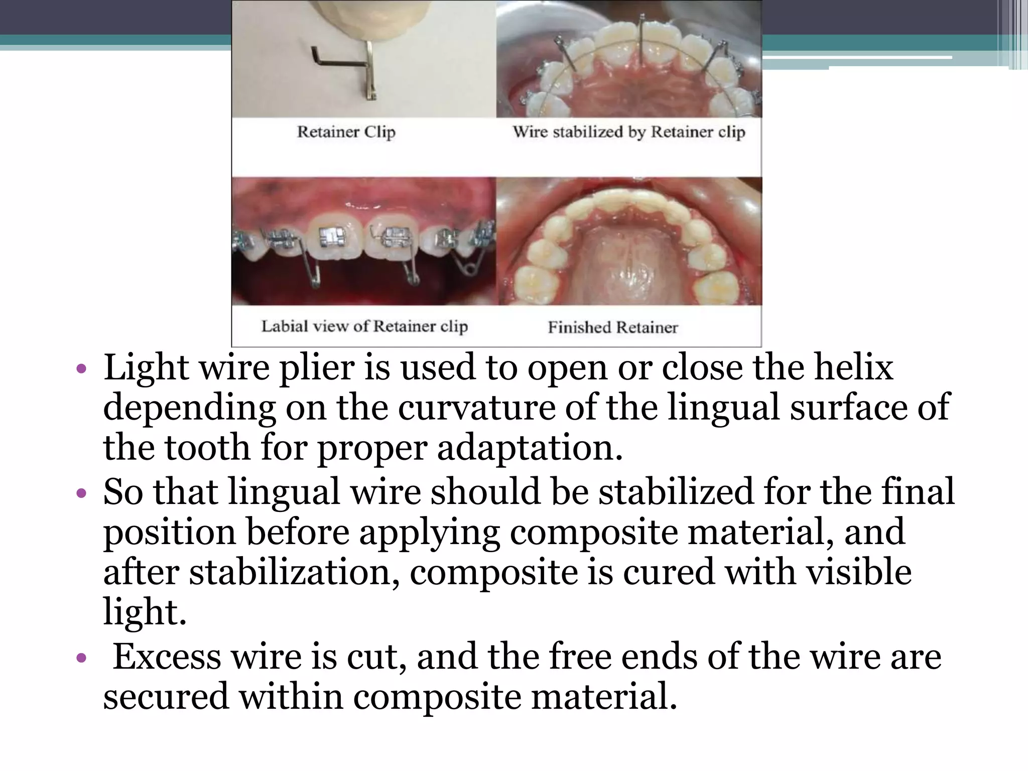 retainer clip | PPTX